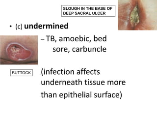 Ulcer drneerajjain | PDF