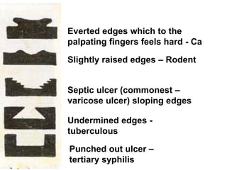 Ulcer drneerajjain | PDF