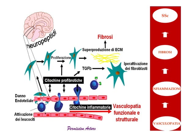 Ulcere digitali sclerodermiche.ppt [compatibility mode] | PDF
