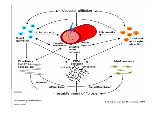 Ulcere digitali sclerodermiche.ppt [compatibility mode] | PDF