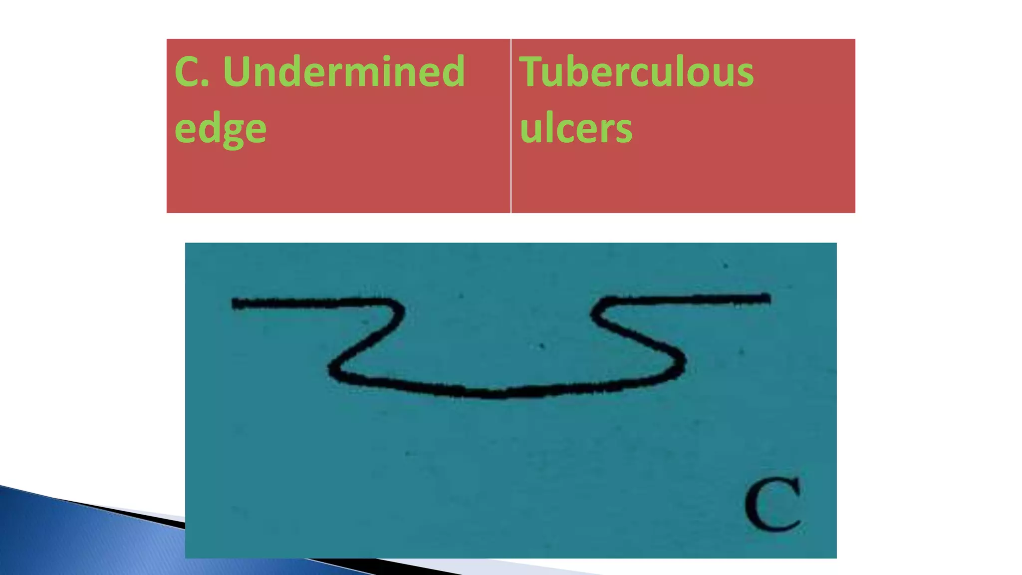 Ulcer examination | PPTX