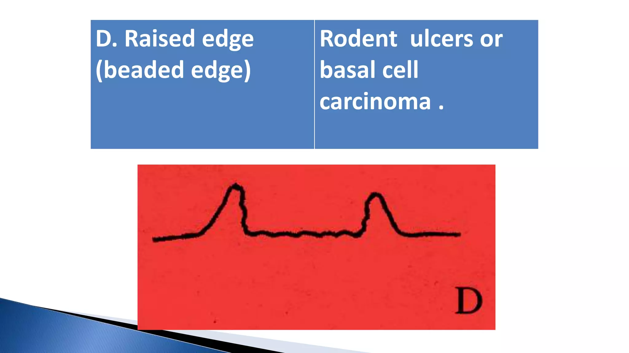 Ulcer examination | PPTX