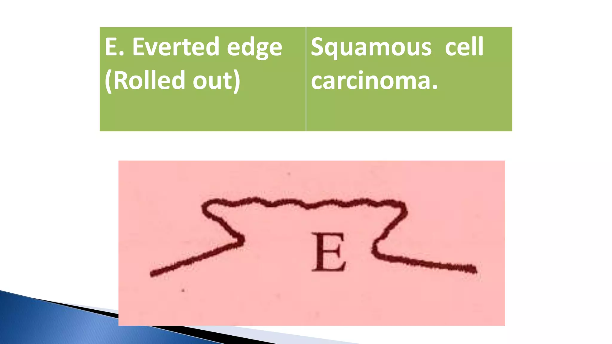 Ulcer examination | PPTX