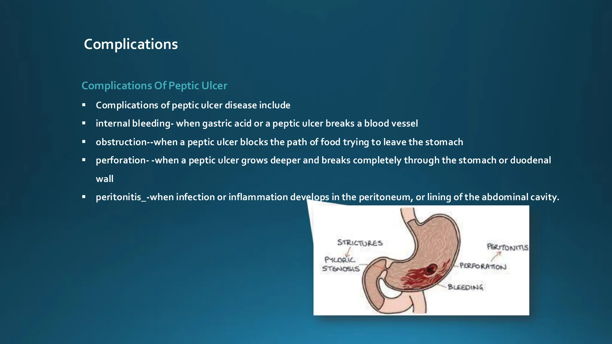 ulcer ppt (2) (2).pdf presentation pdf.f | PDF