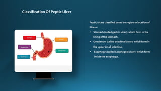 ulcer ppt (2) (2).pdf presentation pdf.f | PDF