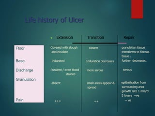 Ulcer presentation | PPTX