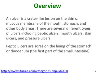 Ulcers | PPTX