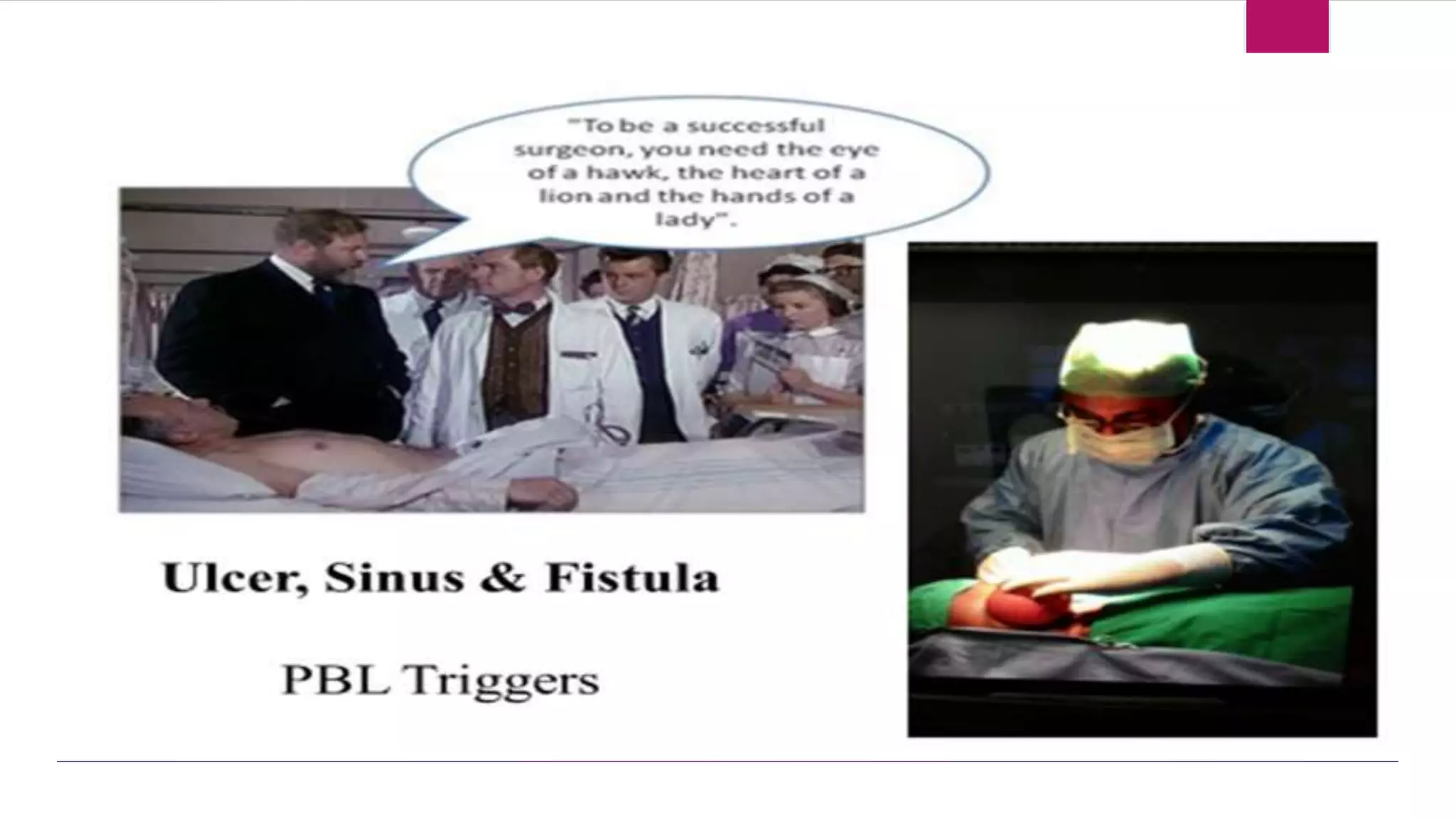 Ulcer, sinus and fistula/ pbl case scenario triggers | PPT