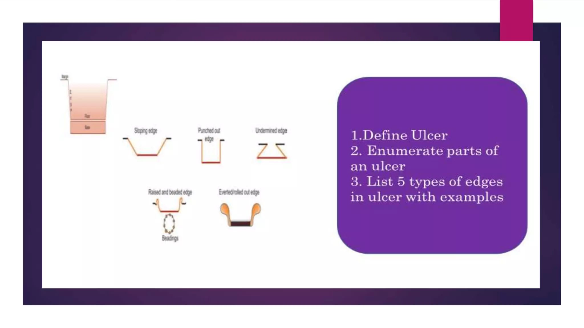 Ulcer, sinus and fistula/ pbl case scenario triggers | PPT