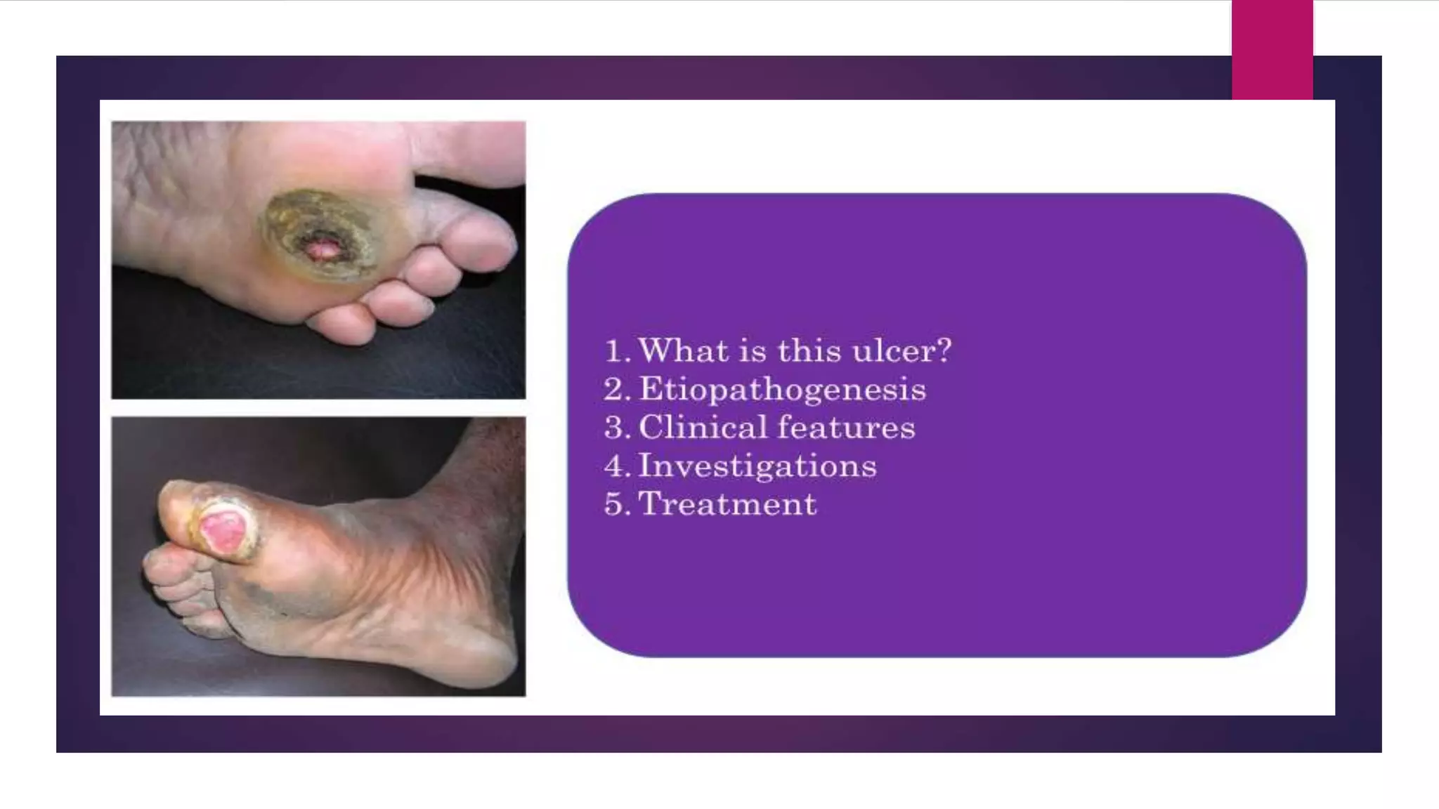 Ulcer, sinus and fistula/ pbl case scenario triggers | PPT