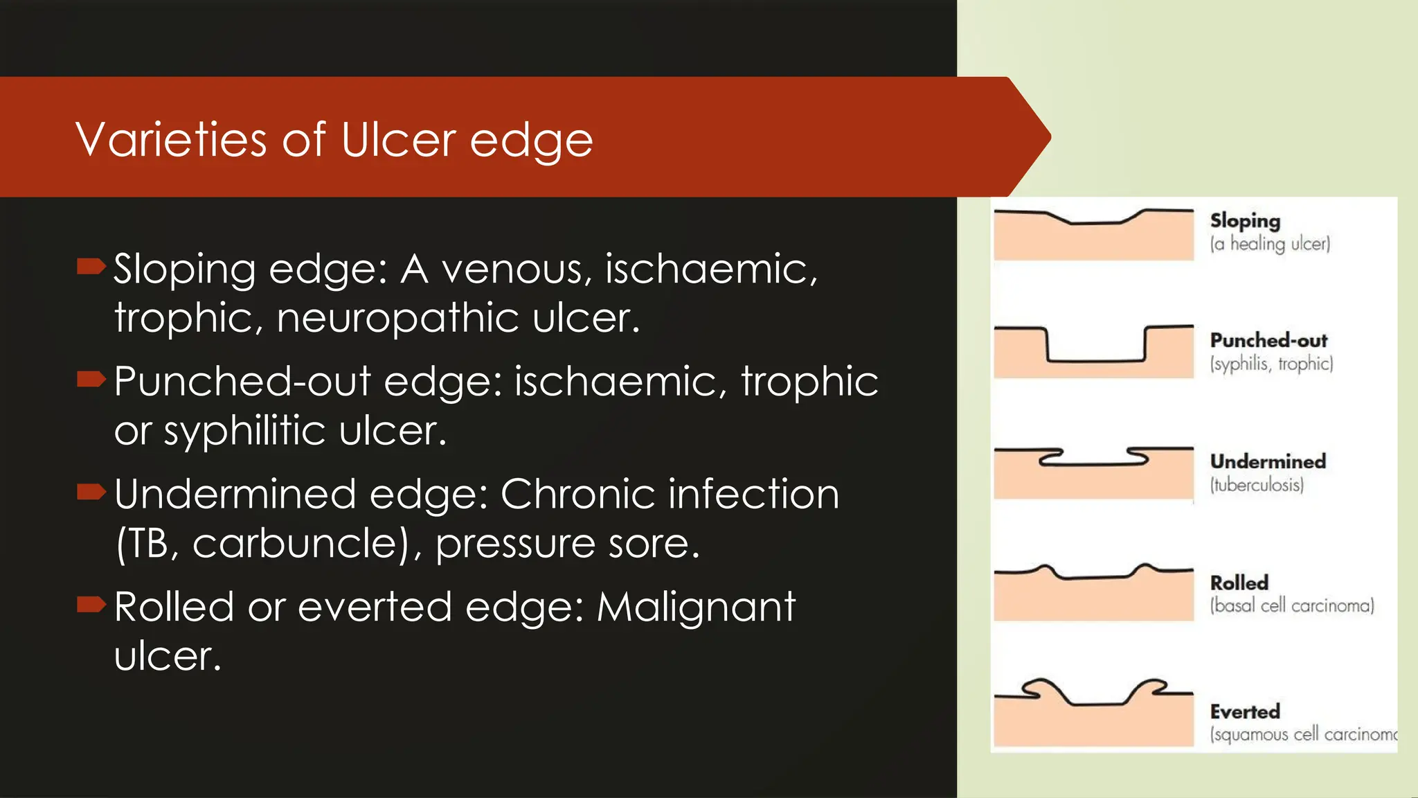 ULCER, SINUS, abscess, fistula vewry basics.pptx