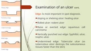 ULCER, SINUS, abscess, fistula vewry basics.pptx