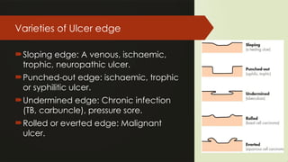 ULCER, SINUS, abscess, fistula vewry basics.pptx