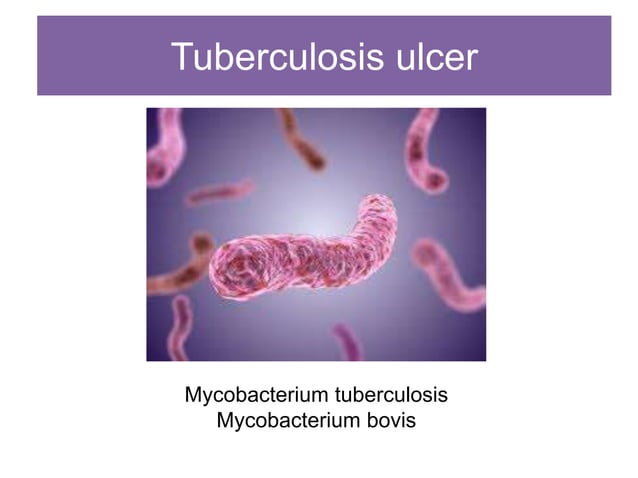 ulcersoftheintestinepatjology170305141940.pptx