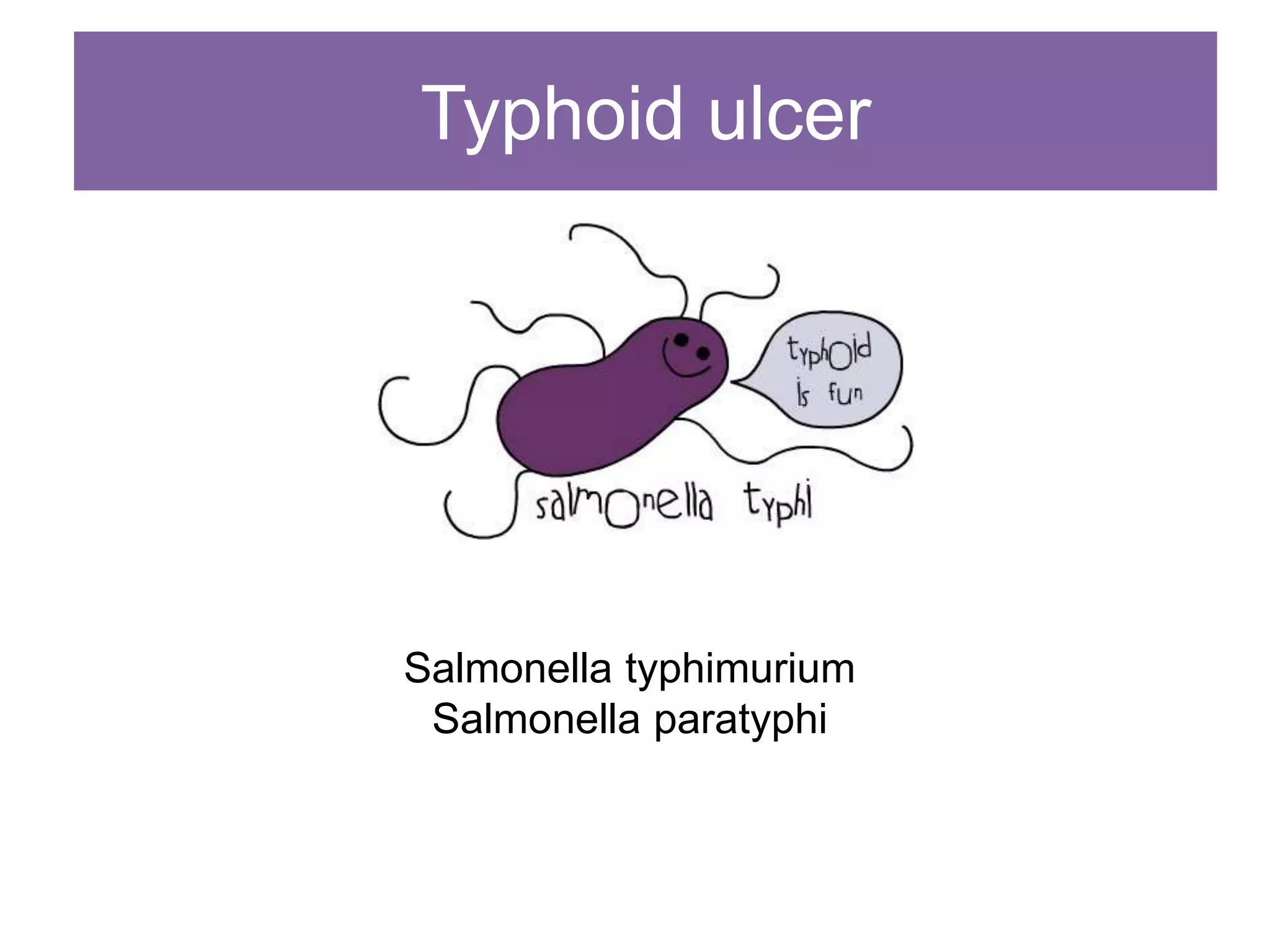 Ulcers of the intestine | PPTX