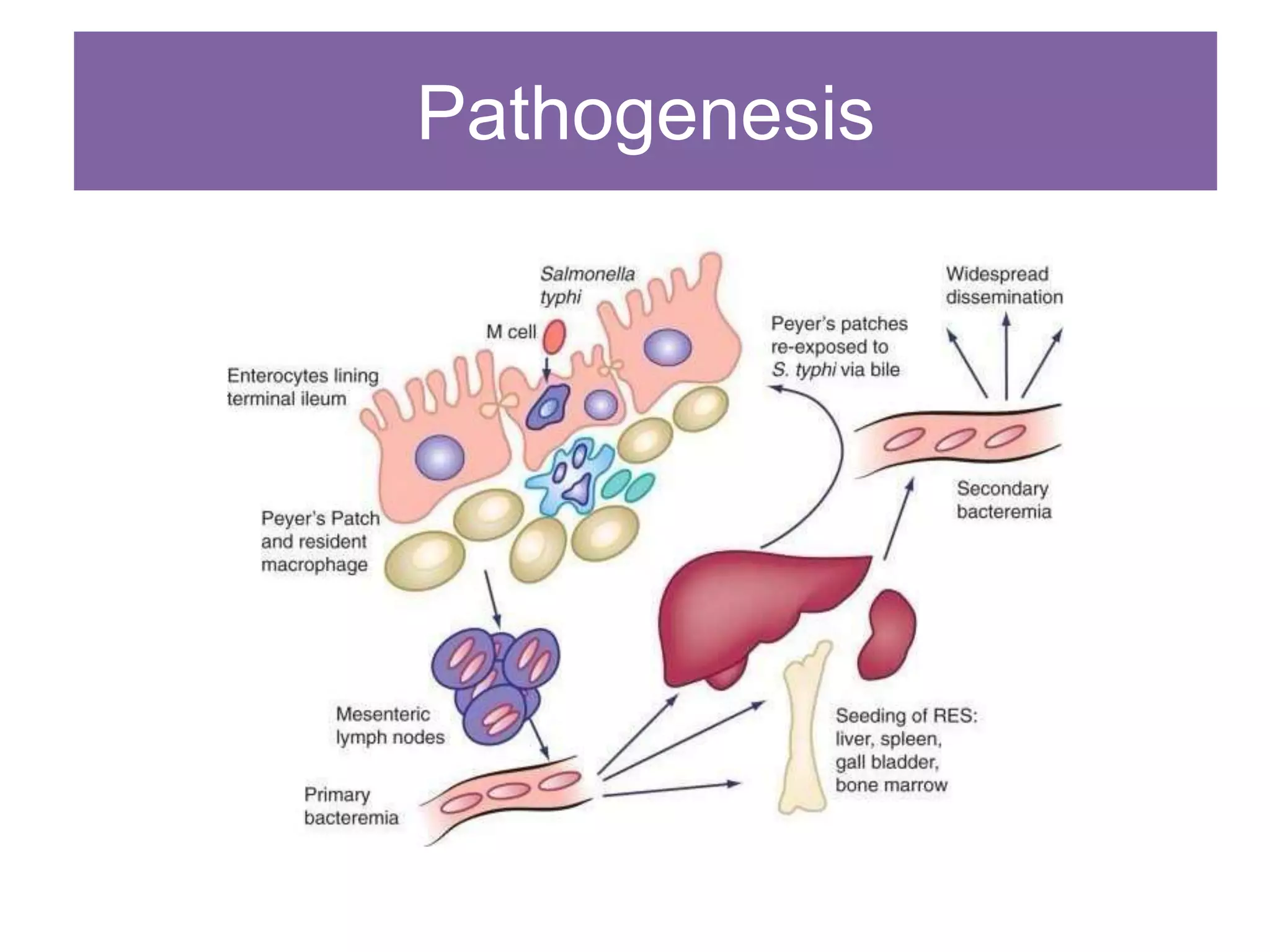 Ulcers of the intestine | PPTX