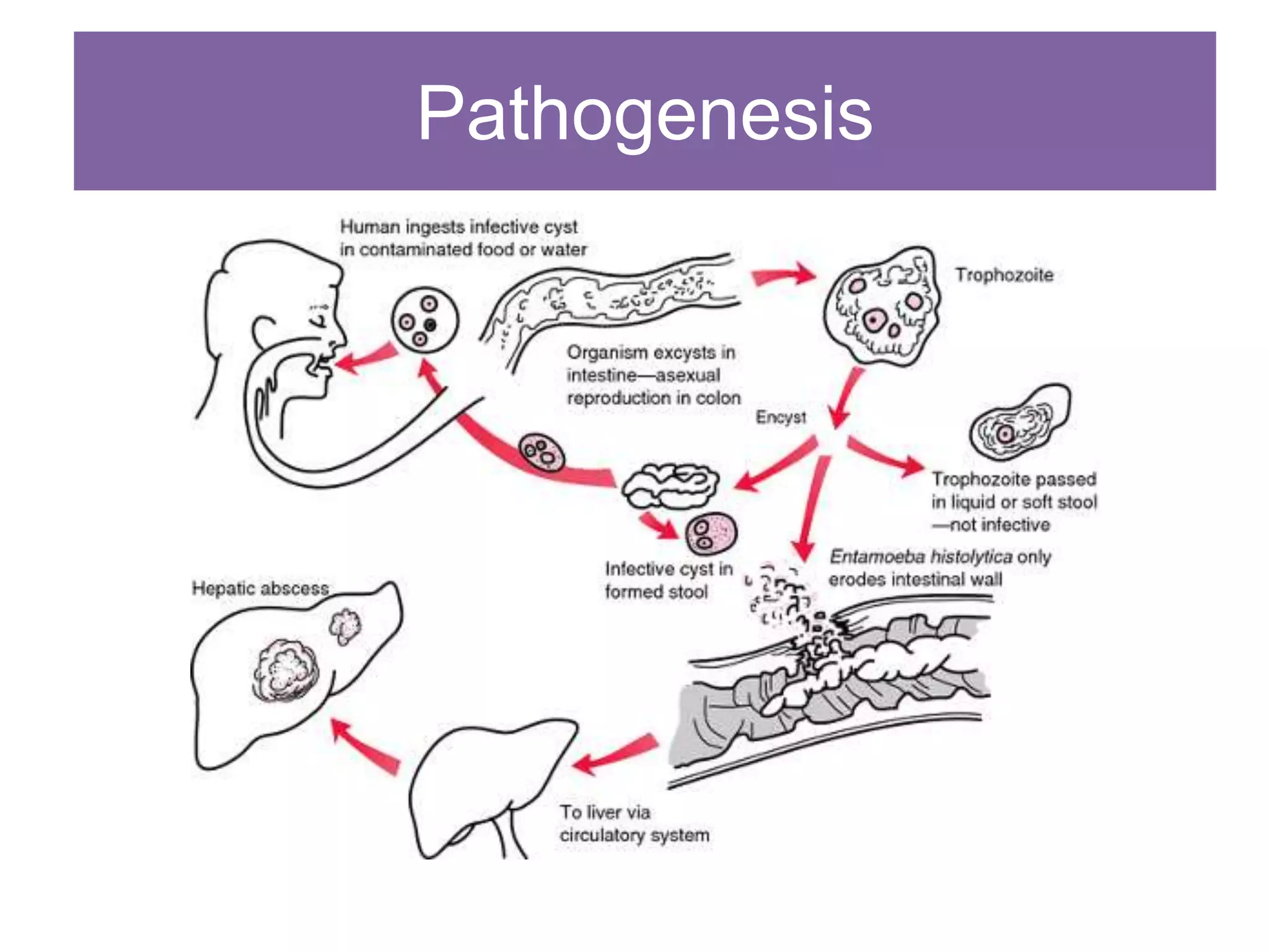 Ulcers of the intestine | PPTX