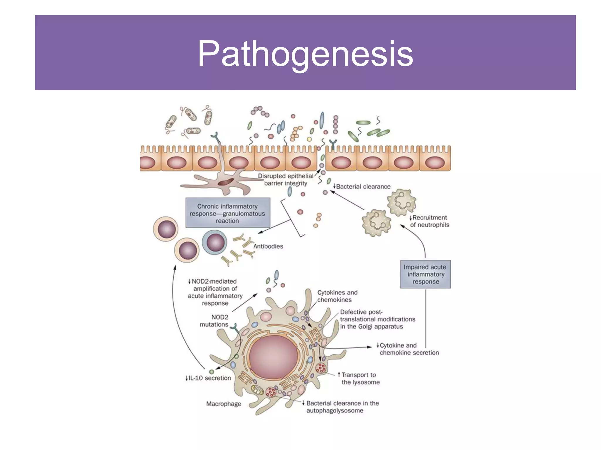 Ulcers of the intestine | PPTX