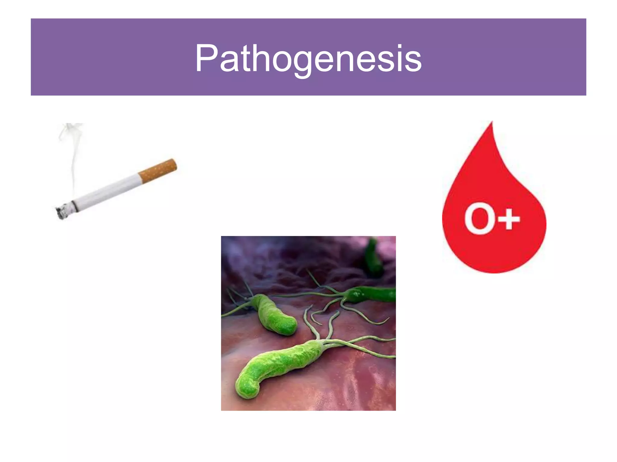 Ulcers of the intestine | PPTX