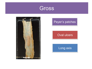 Peyers Patches Gross