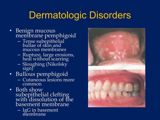 Ulcers of the oral Cavity Arshad.pptx | Ear, Nose and Throat Conditions ...