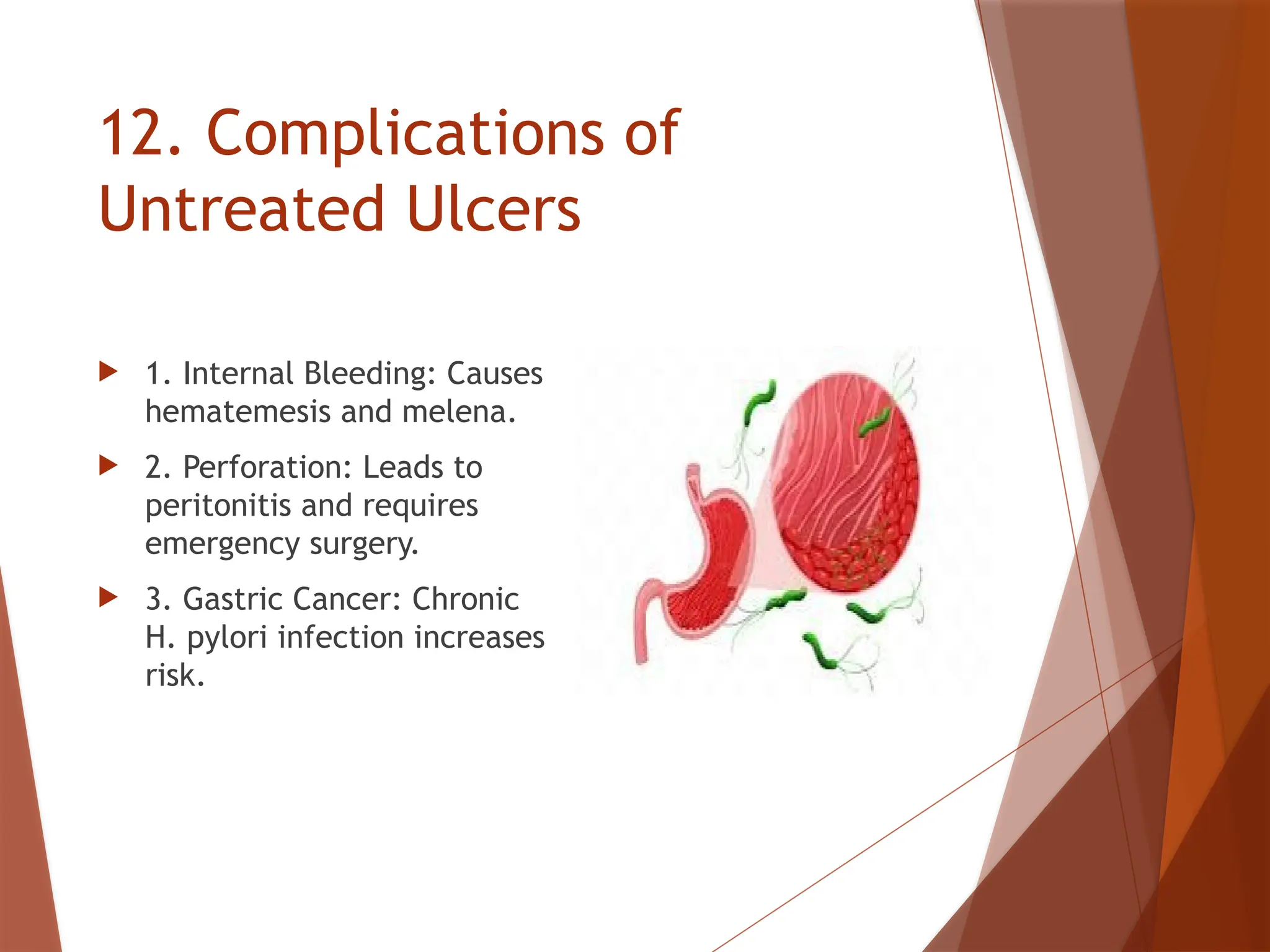 Ulcers_Presentation (2).pptx pharmacology | PPTX