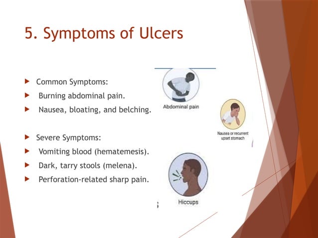 Ulcers_Presentation (2).pptx pharmacology | PPTX