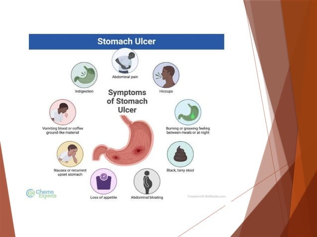 Ulcers_Presentation (2).pptx pharmacology | PPTX