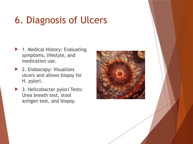 Ulcers_Presentation (2).pptx pharmacology | PPTX