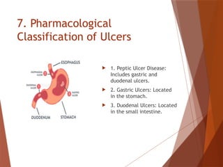 Ulcers_Presentation (2).pptx pharmacology | PPTX