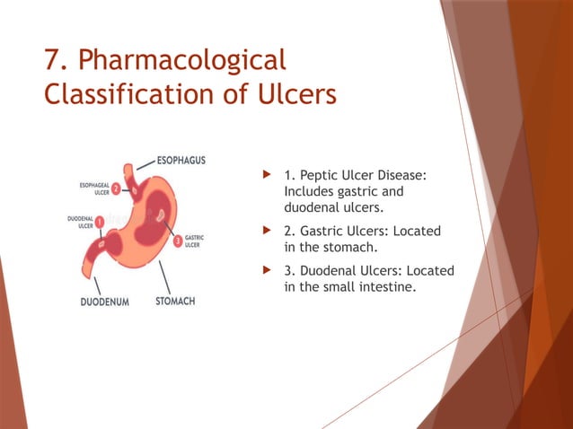 Ulcers_Presentation (2).pptx pharmacology | PPTX