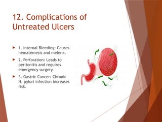 Ulcers_Presentation (2).pptx pharmacology | PPTX