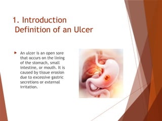 Ulcers_Presentation (2).pptx pharmacology | PPTX