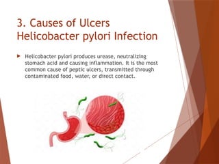 Ulcers_Presentation (2).pptx pharmacology | PPTX