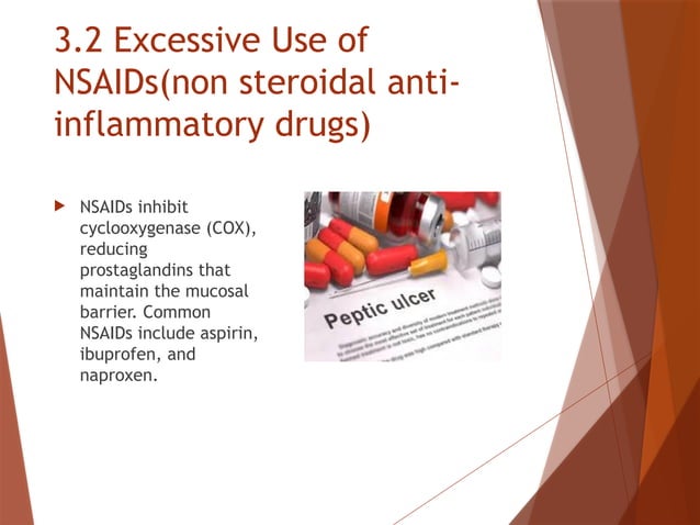 Ulcers_Presentation (2).pptx pharmacology | PPT