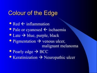 ULCERS, SINUSES & FISTULAE in surgical patients.ppt