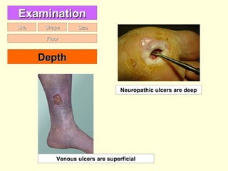 Leg Ulcers - Clinical diagnosis | PPT