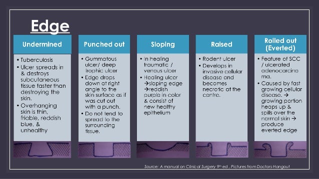 Ulcers & skin infections