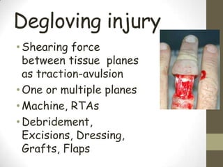 Ulcers & wounds | PPTX