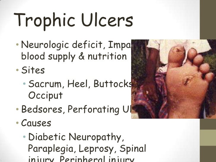 Ulcers & wounds