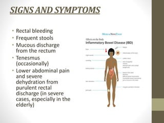 Ulcertative colitis | PPT