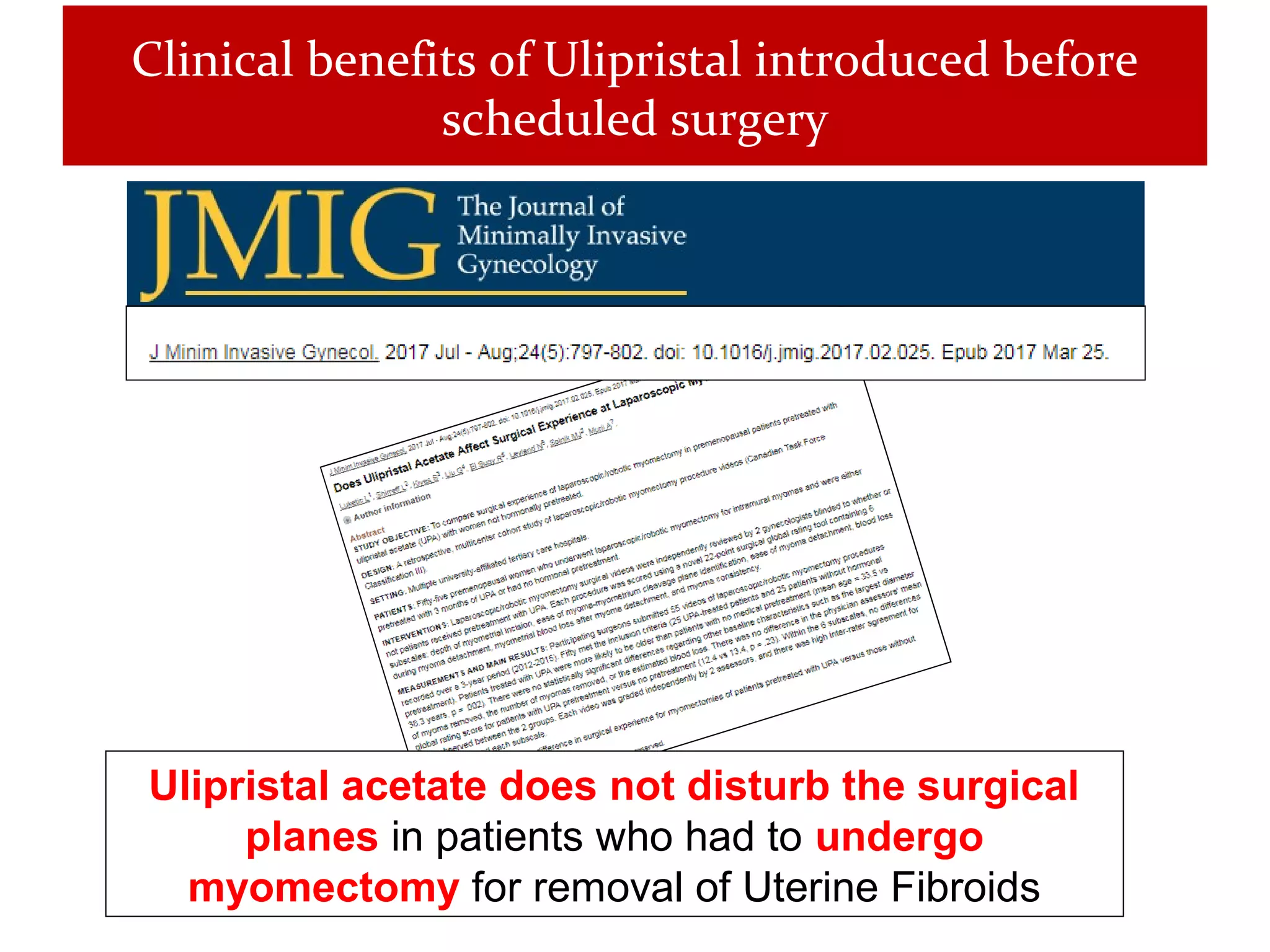 Medical Management of Fibroids | PPT