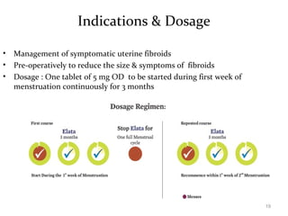 Medical Management of Fibroids | PPT