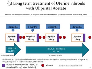 Medical Management of Fibroids | PPT