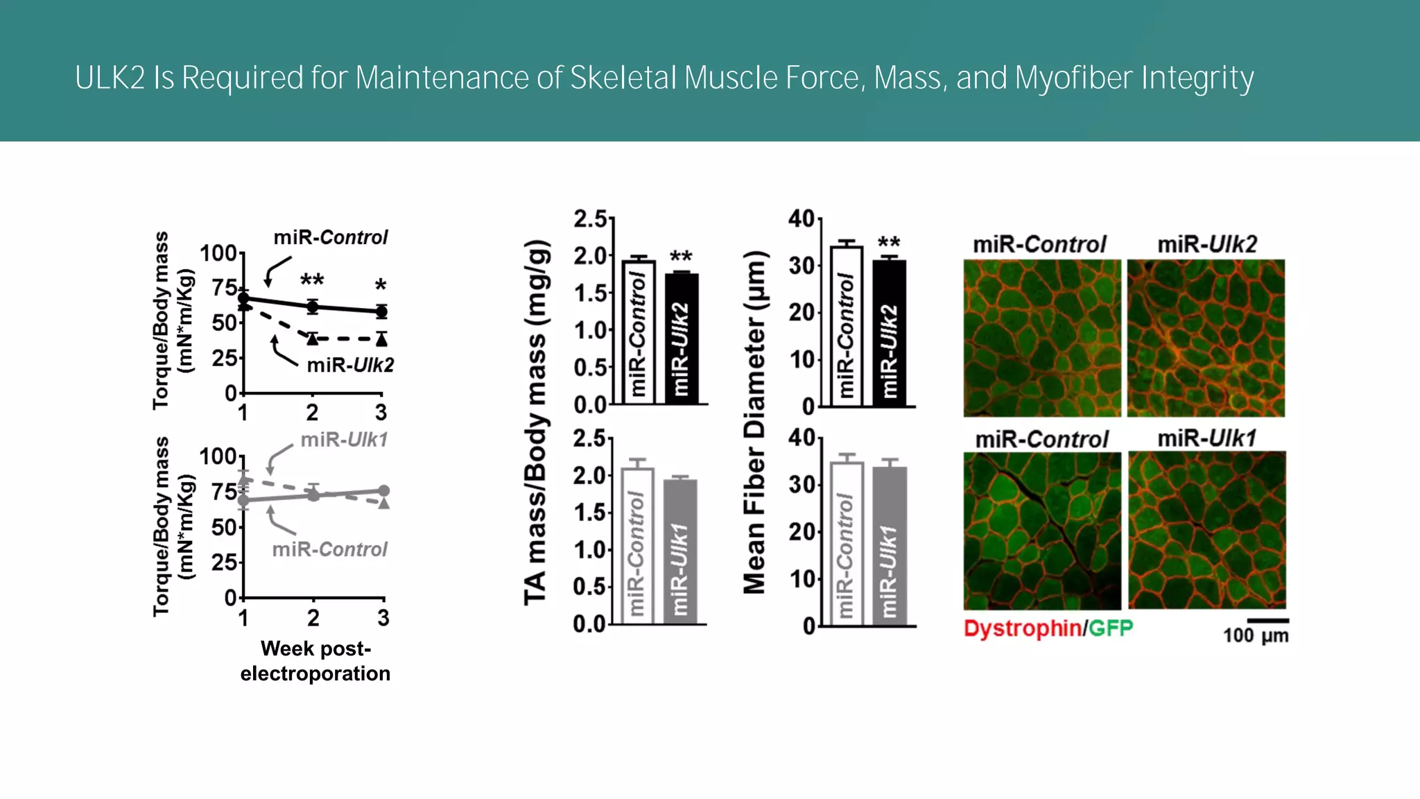 ULK2 is essential for degradation of ubiquitinated protein aggregates ...