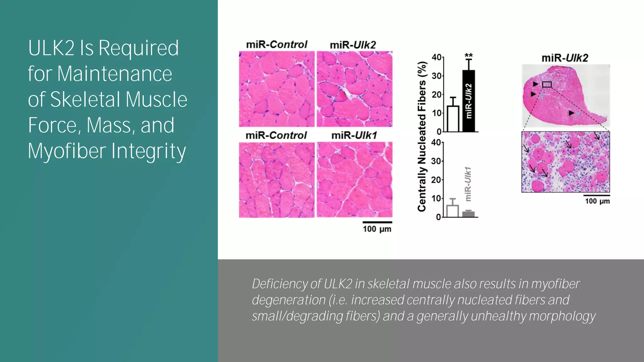 ULK2 is essential for degradation of ubiquitinated protein aggregates ...
