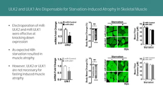 ULK2 is essential for degradation of ubiquitinated protein aggregates ...