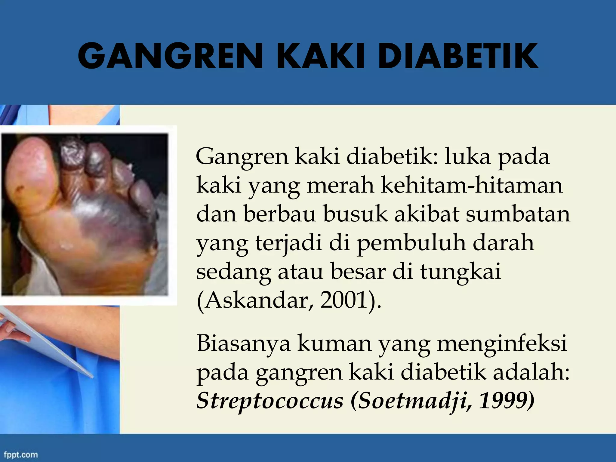 Ulkus diabetikum | PPT