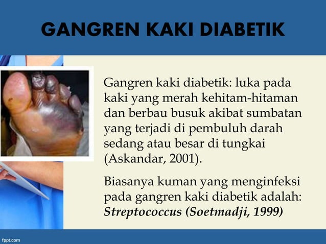 Ulkus diabetikum | PPT