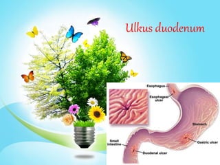 Ulkus duodenum.ppt